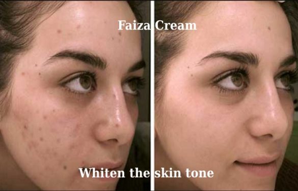 Faiza Cream – Features, Side effects, How to use? Is it harmful to skin?